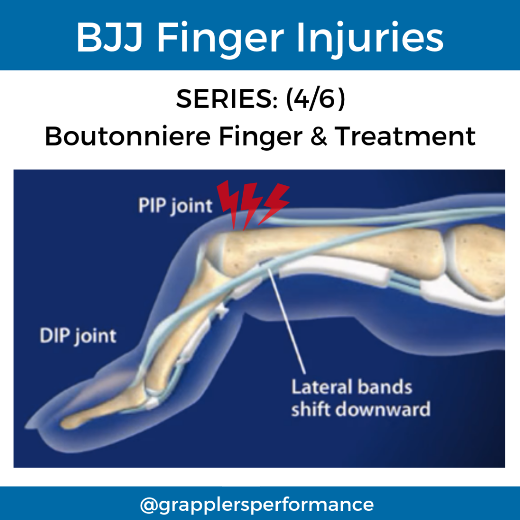 Common BJJ Finger Injuries: Part 2 - Grapplers Performance